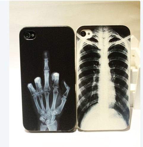 X-ray Skull Bone Case Iphone 4/4s/5 on Luulla